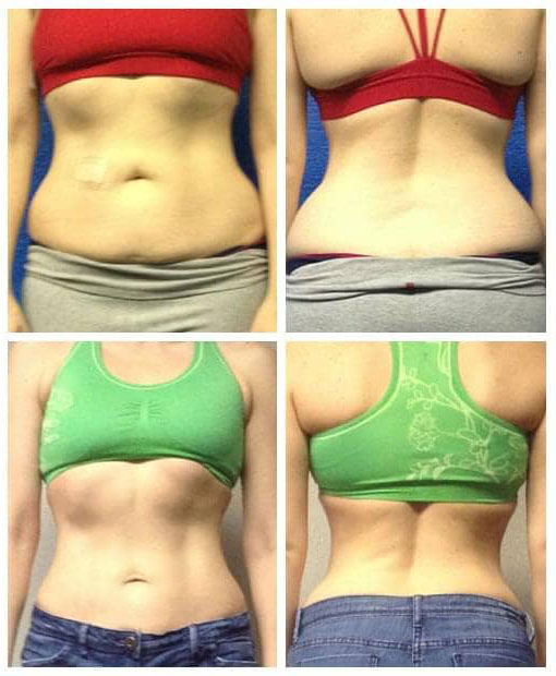 Turboslim en Peru para bajar de peso: contraindicaciones, efecto rebote